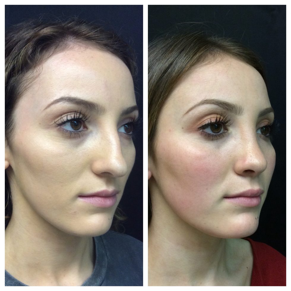 Yale Kadesky - San Diego Plastic Surgeon - Cosmetic Surgery CA